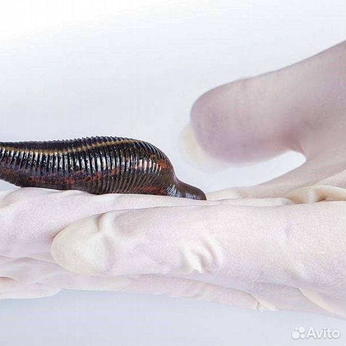 Пиявка аптекарская