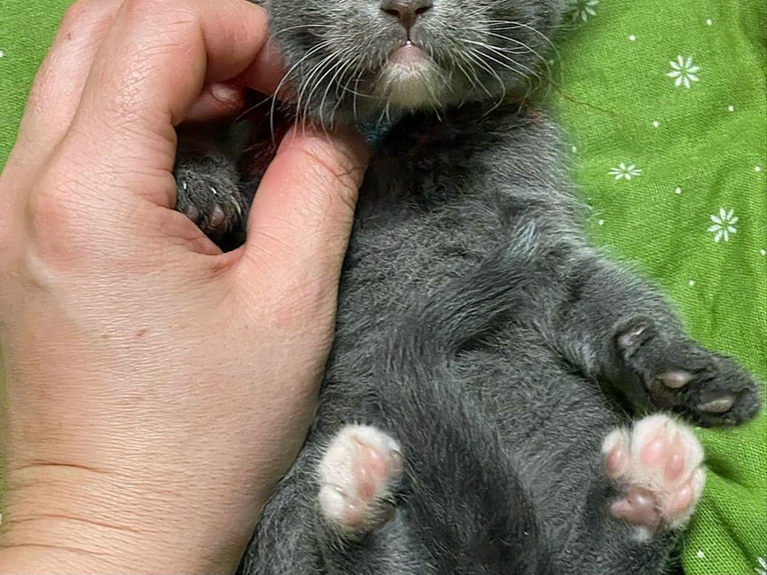 Разноглазая девочка дбе